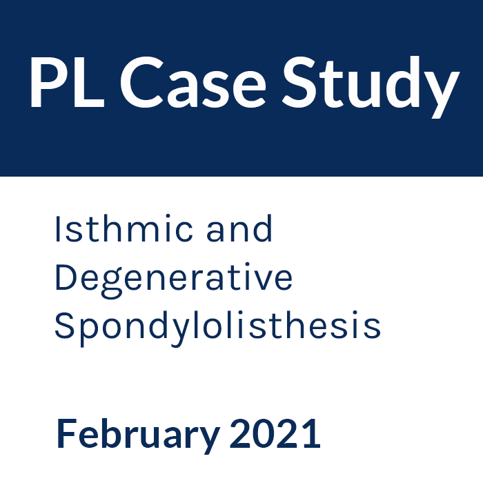 Isthmic and Degenerative Spondylolisthesis | February 2021 - Rapid ...