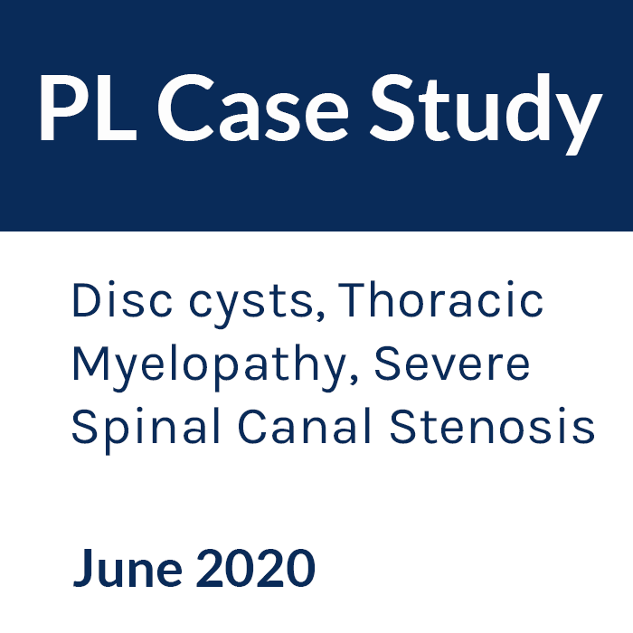 Disc cysts, Thoracic Myelopathy, Severe Spinal Canal Stenosis | June ...